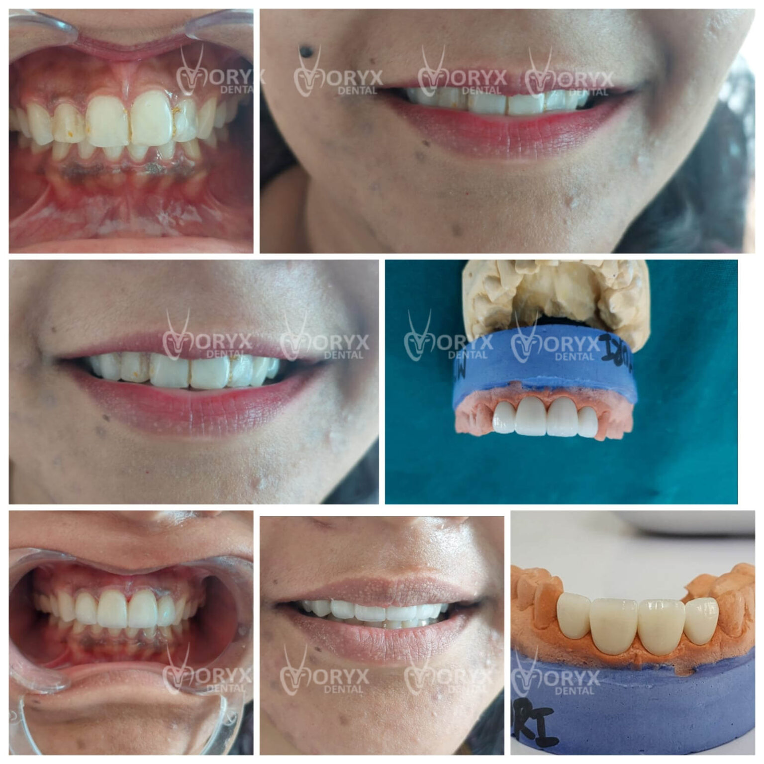 Gallery - ORYX Dental