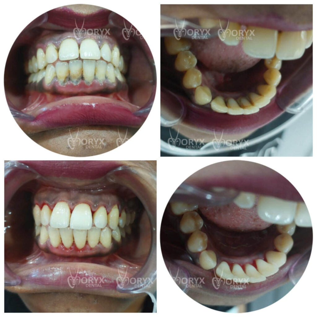 Gallery - ORYX Dental